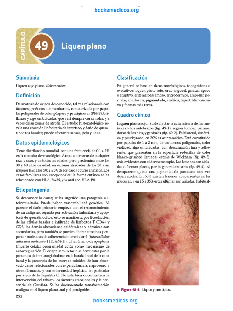 Liquen Plano | PDF | Medicina CLINICA | Causas de la muerte