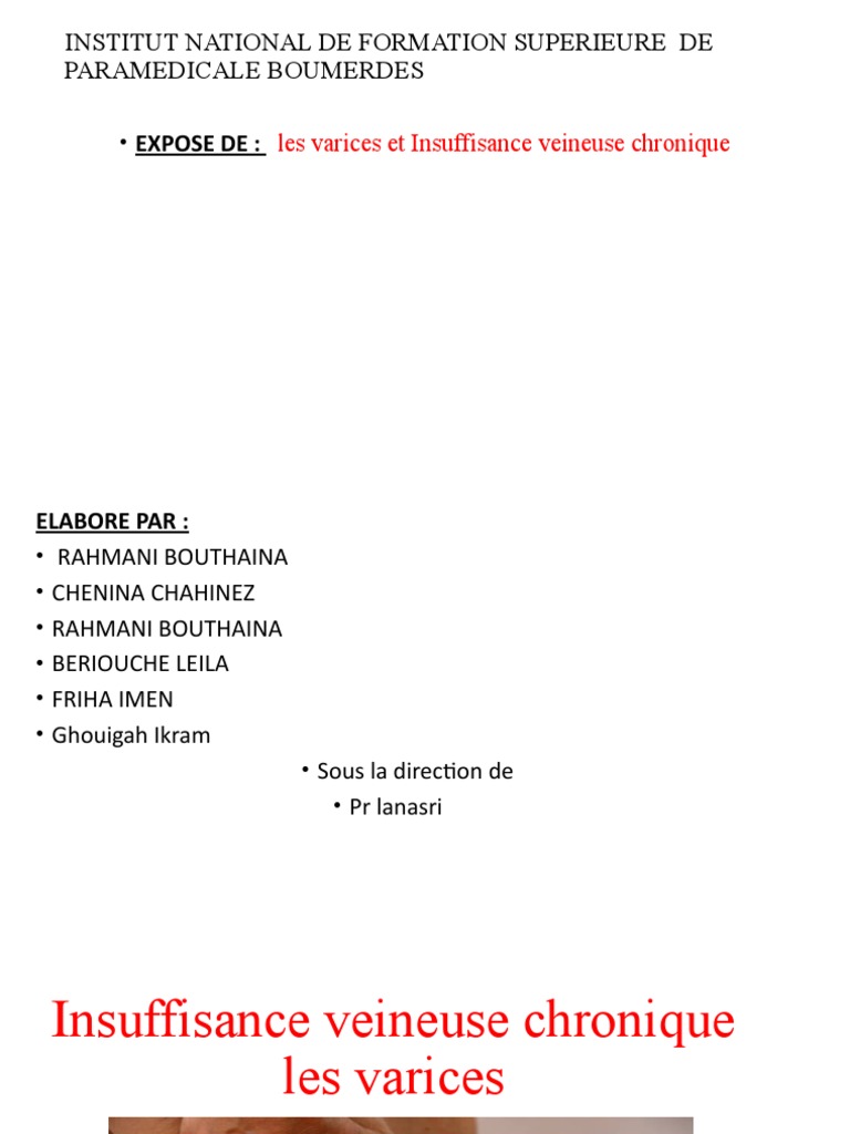 Varice | PDF | Varices | Médecine clinique