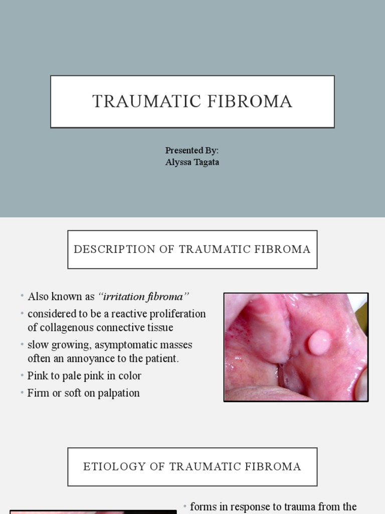 Traumatic Fibroma | PDF | Morphology (Biology) | Medicine