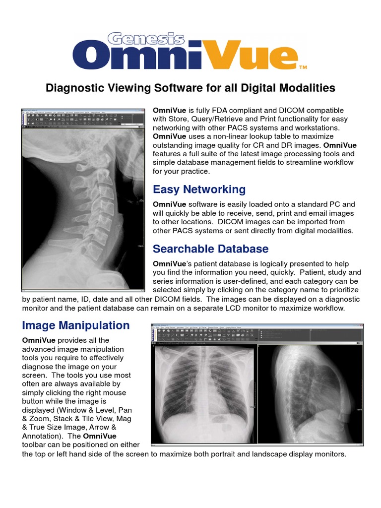 Brochure Genesis OmniVue 2014 | PDF