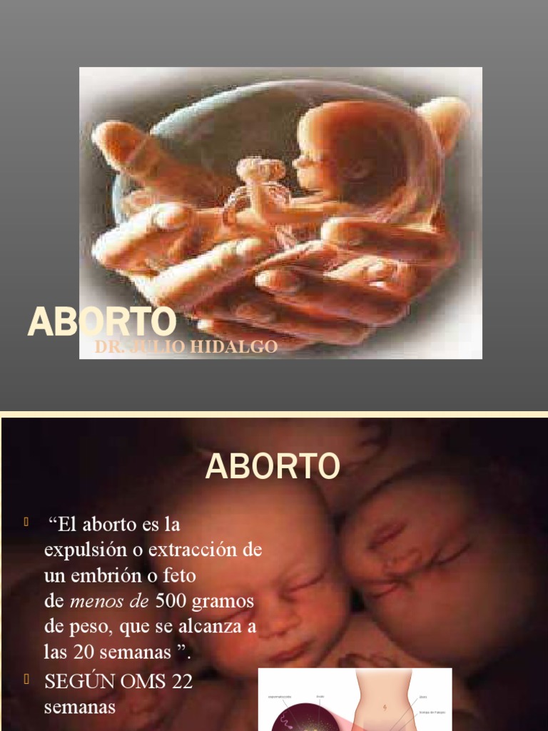 Clasificación y Manejo del Aborto | PDF | Aborto espontáneo | El embarazo
