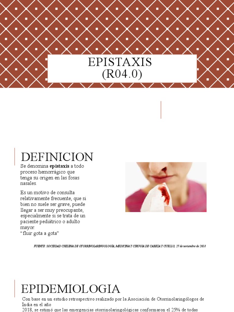 Epistaxis | PDF