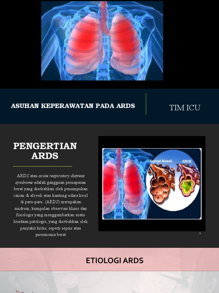 Askep Ards Icu Fix - 1 | PDF