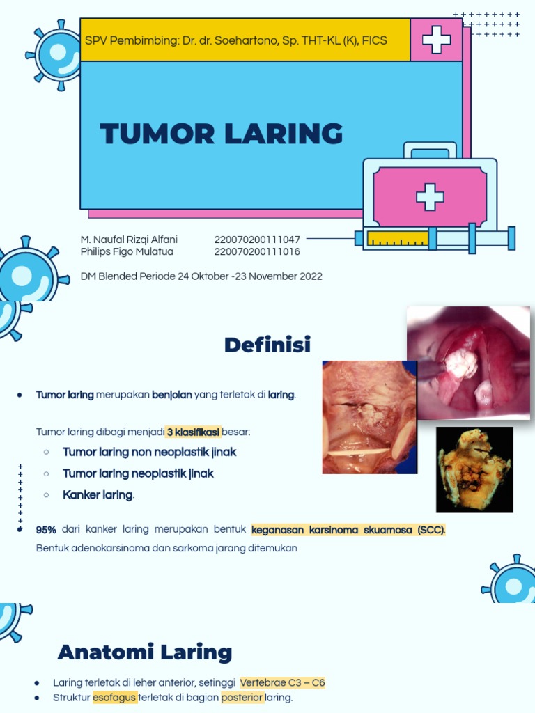 Anatomy, Types, and Management of Benign Laryngeal Tumors | PDF