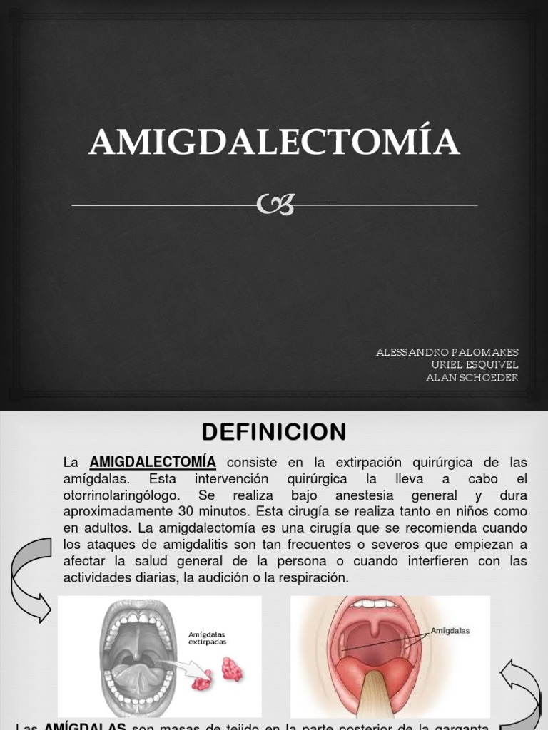 AMIGDALECTOMÍA | PDF | Cirugía | Medicina CLINICA