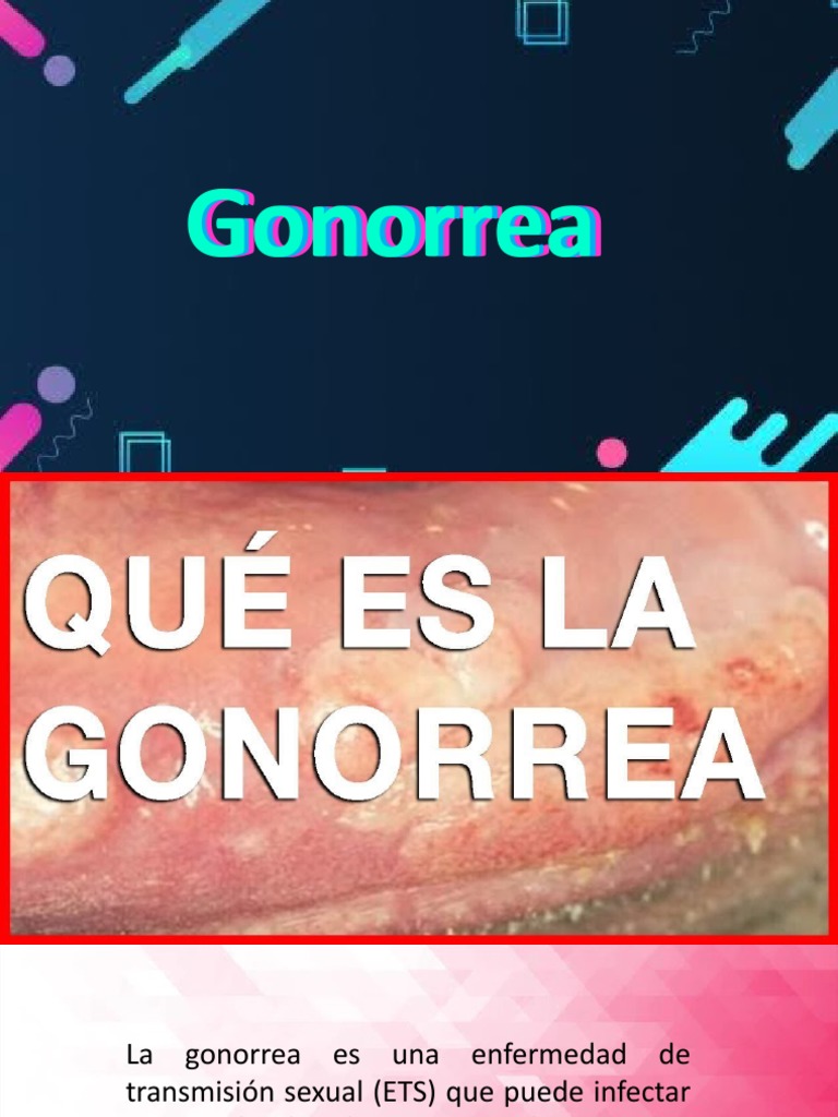 Gonorrea | PDF | Infección transmitida sexualmente | Especialidades Medicas