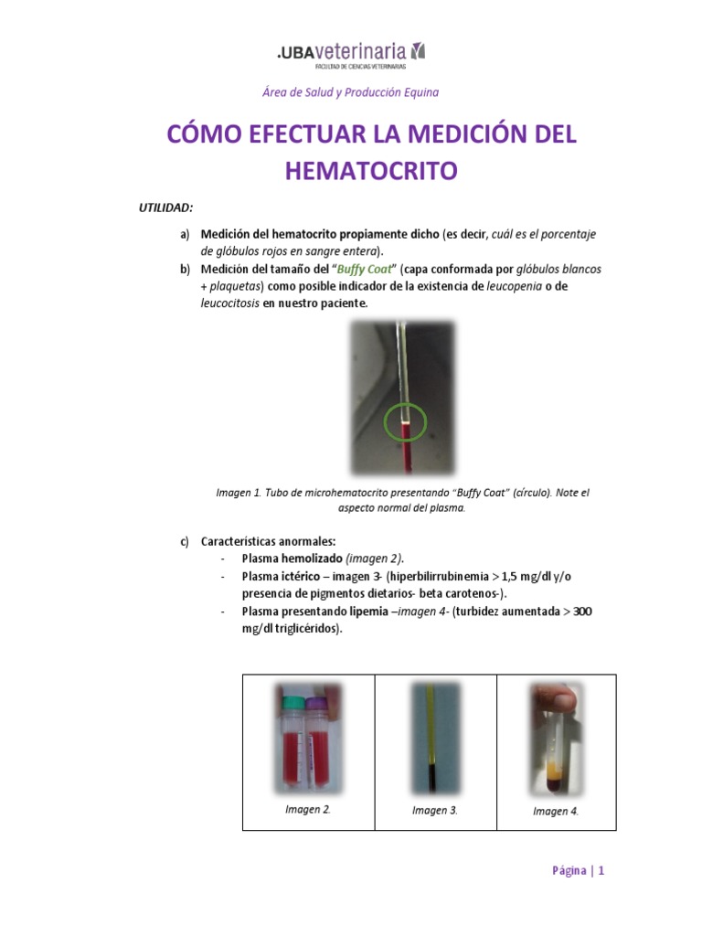 Cómo Determinar El HEMATOCRITO | PDF