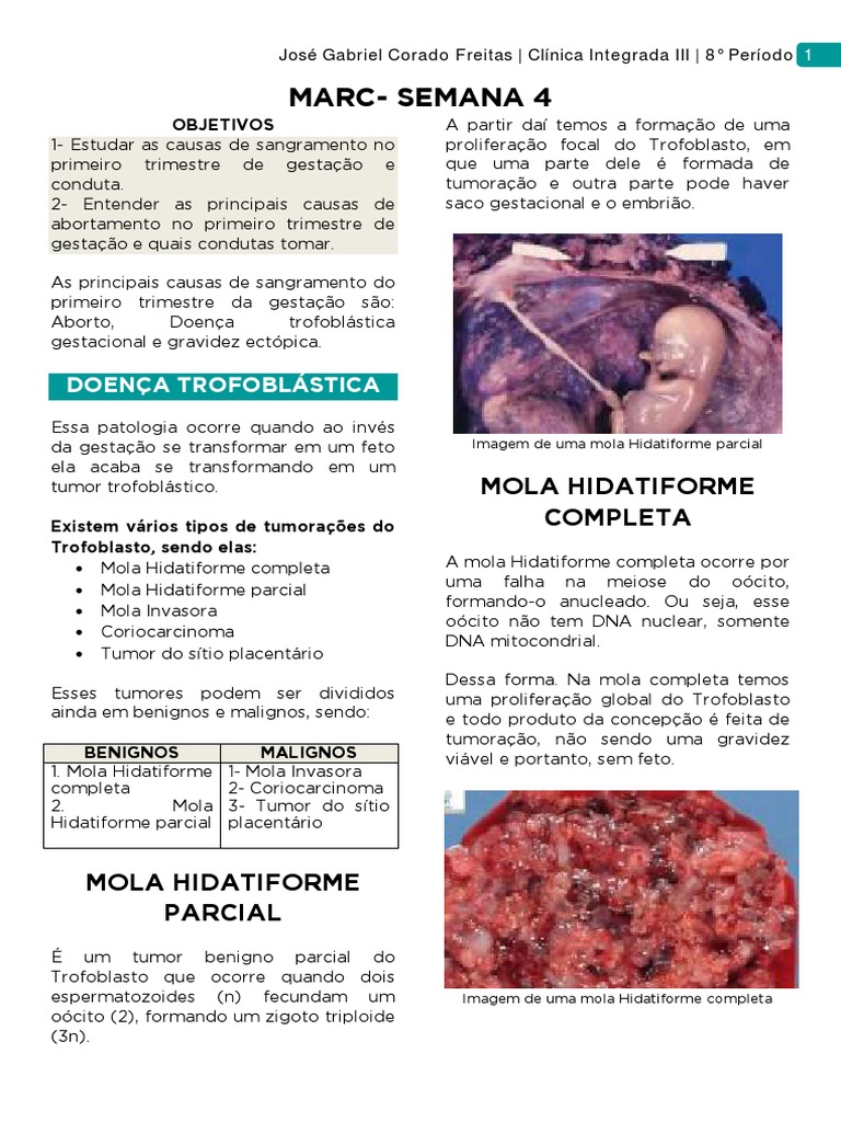 Marc 4 - Sangramentos Do Primeiro Trimestre | PDF