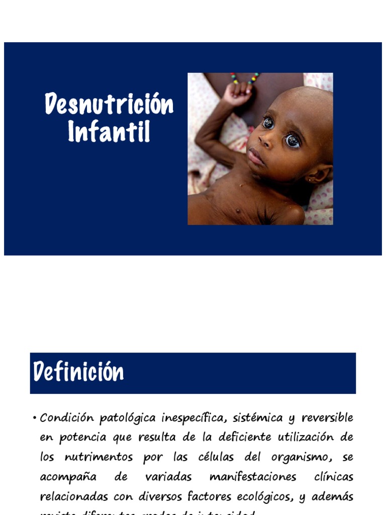 Desnutrición Infantil Pdf