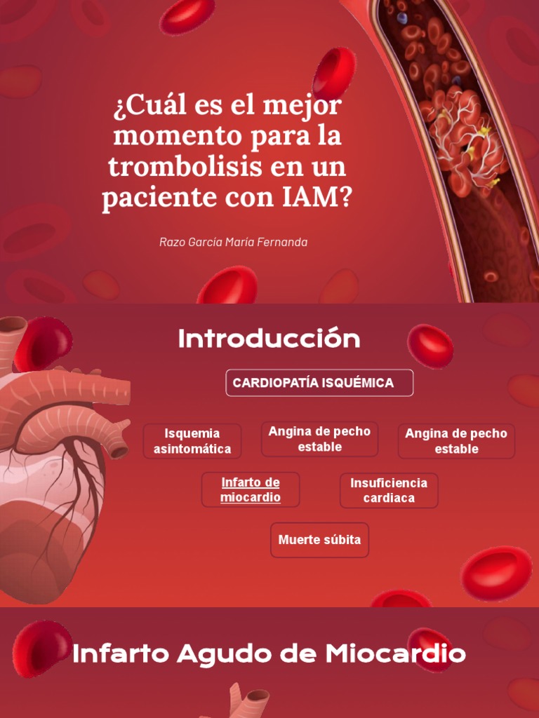 Momento óptimo para trombolisis en IAM | PDF | Infarto de miocardio ...