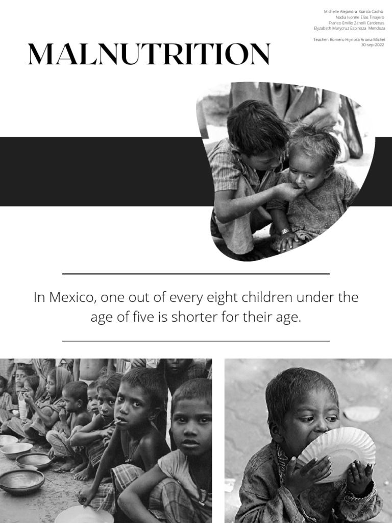 Malnutrition Project | PDF | Malnutrition | Breastfeeding