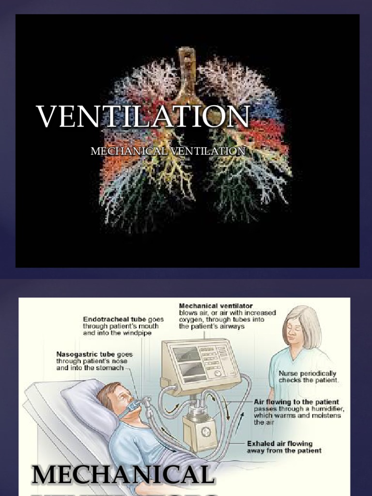 Mechanical Ventilation | PDF | Respiratory System | Human Diseases And ...