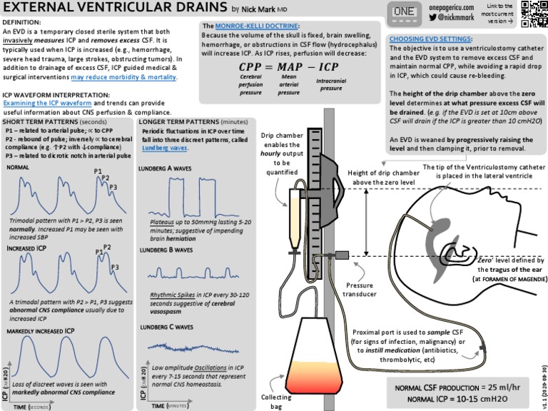 ICU One Pager EVD V11 | PDF | Neurology | Cardiovascular System