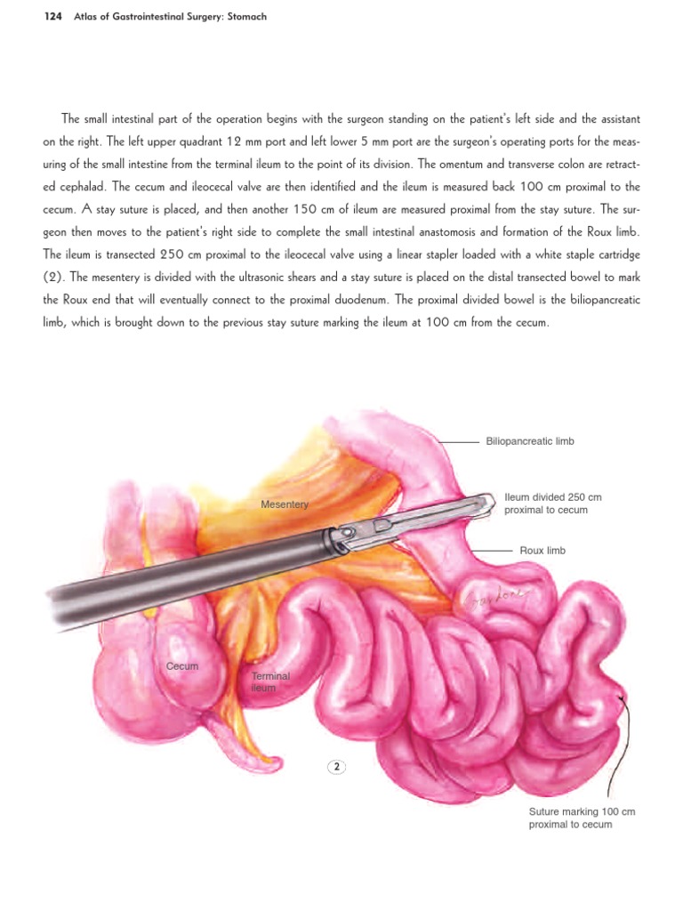 Atlas of Surgery Cameron Volume II. 2nd | PDF | Gastrointestinal Tract ...