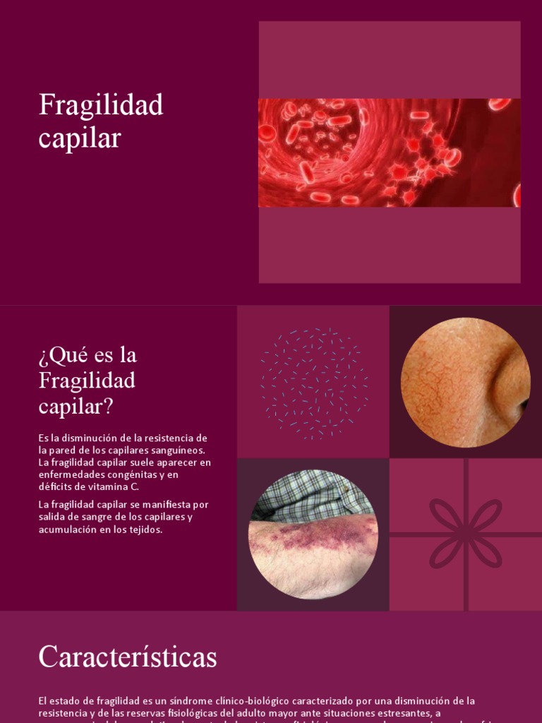 Fragilidad Capilar | PDF | Capilar | Presión sanguínea