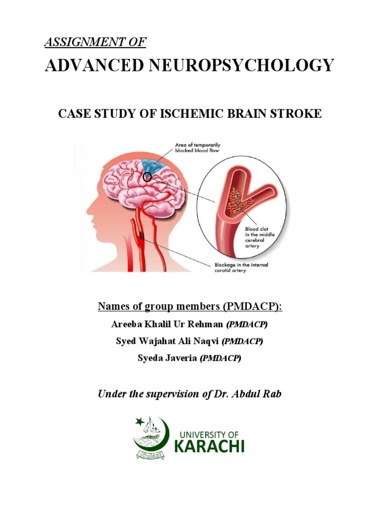 Analysis of Ischemic Brain Stroke Through a Case Study of Middle Cerebellar Peduncle Lesion ...