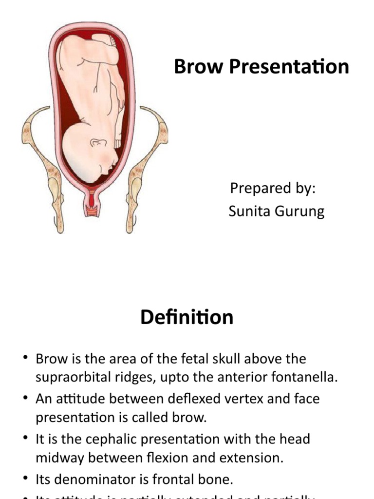Brow Presentation | PDF