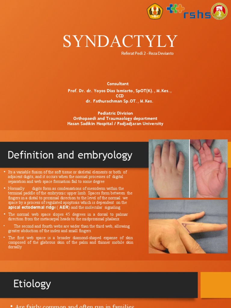 Pediatric Syndactyly Overview | PDF | Finger | Scar