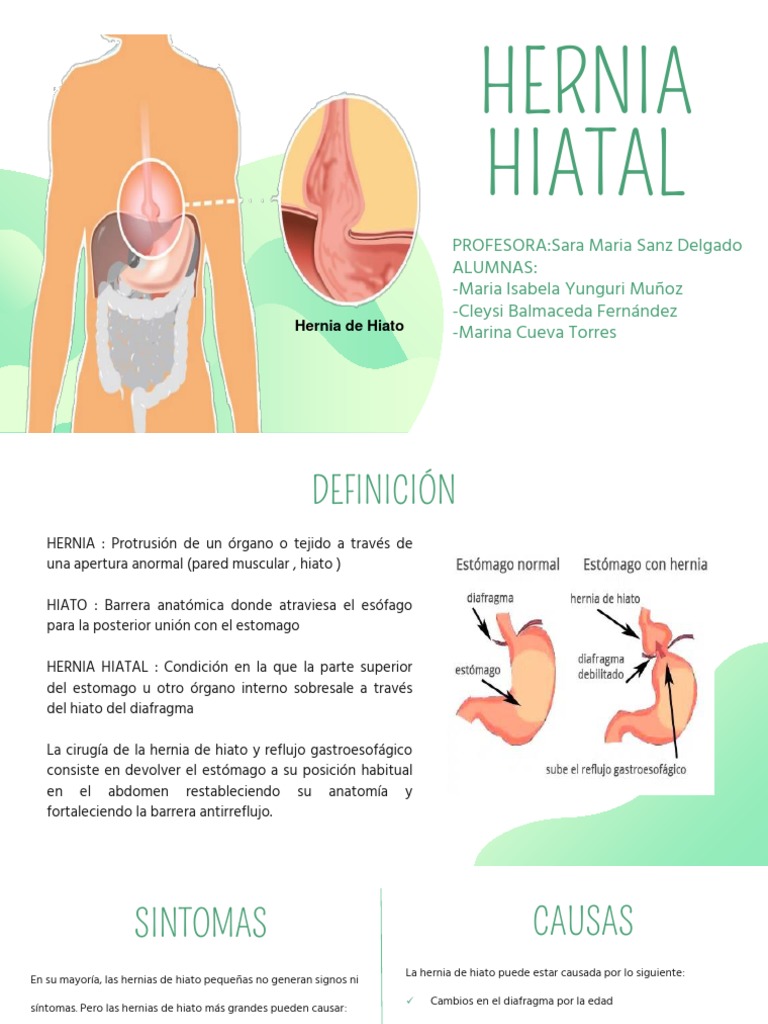 Hernia Hiatal | PDF | La enfermedad por reflujo gastroesofágico | Gastroenterología