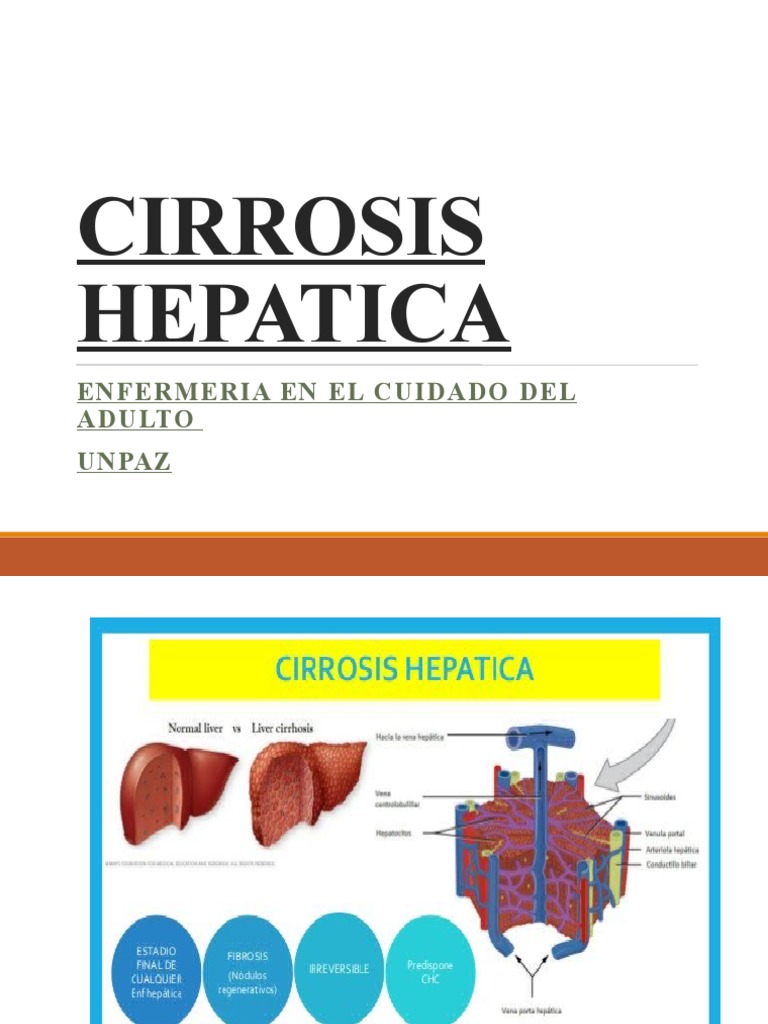 Cirrosis Hepatica | PDF | Cirrosis | Hepatitis