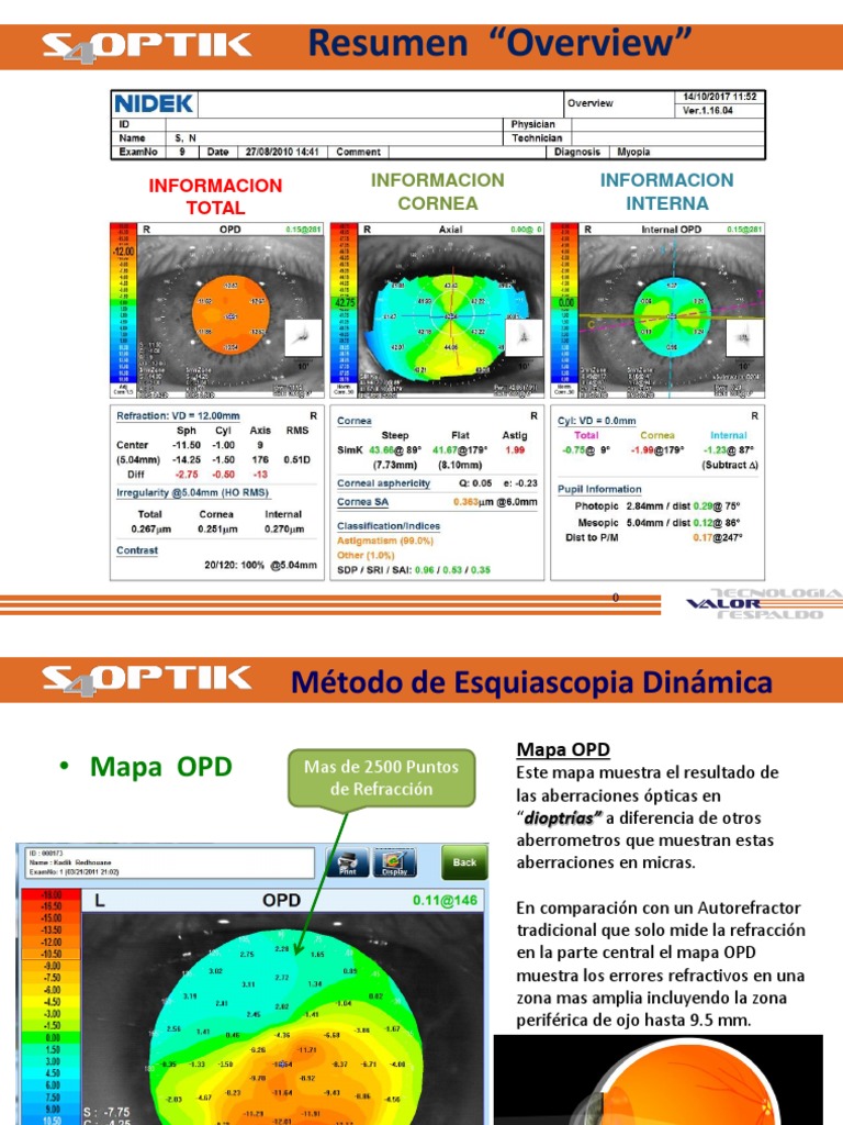 Curso Cliente Opd 3 | PDF | Córnea | Radiación electromagnética