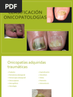 Diapositivas - Exéresis de Uña Encarnada | PDF | Clavo (anatomía ...