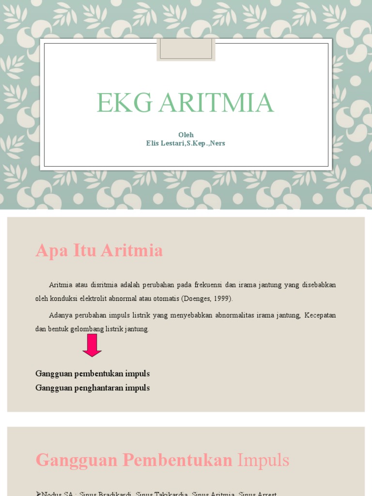Ekg Aritmia | PDF