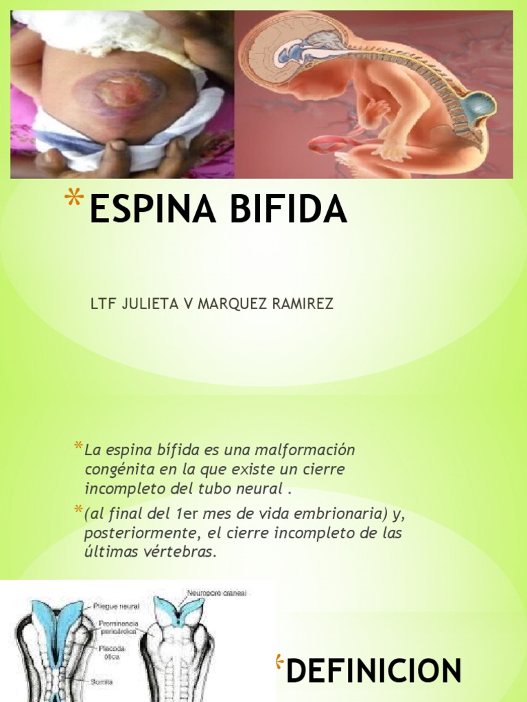 Espina Bifida | PDF