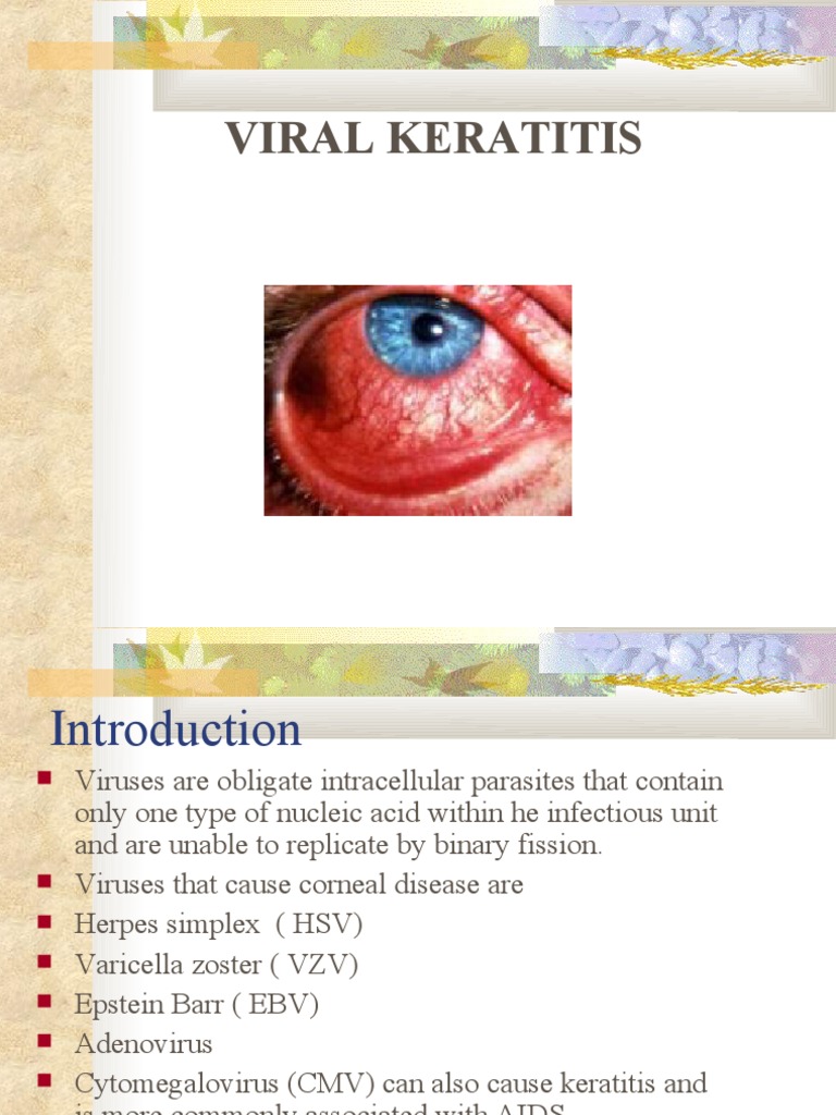 Overview of Viral Keratitis Types | PDF