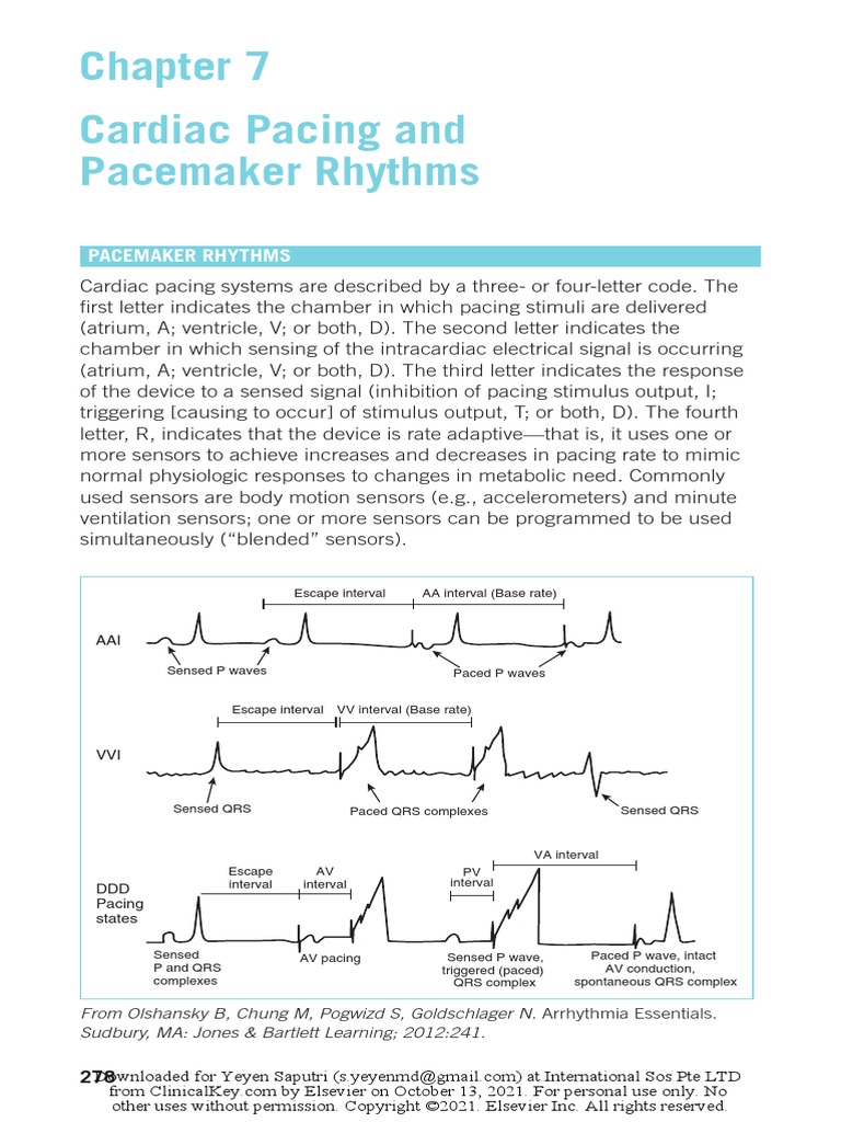 Cardiac Pacing and Pacemaker Rhythms | PDF | Artificial Cardiac ...