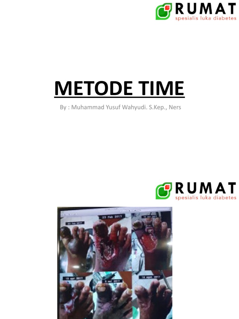 Tugas Metode Time | PDF