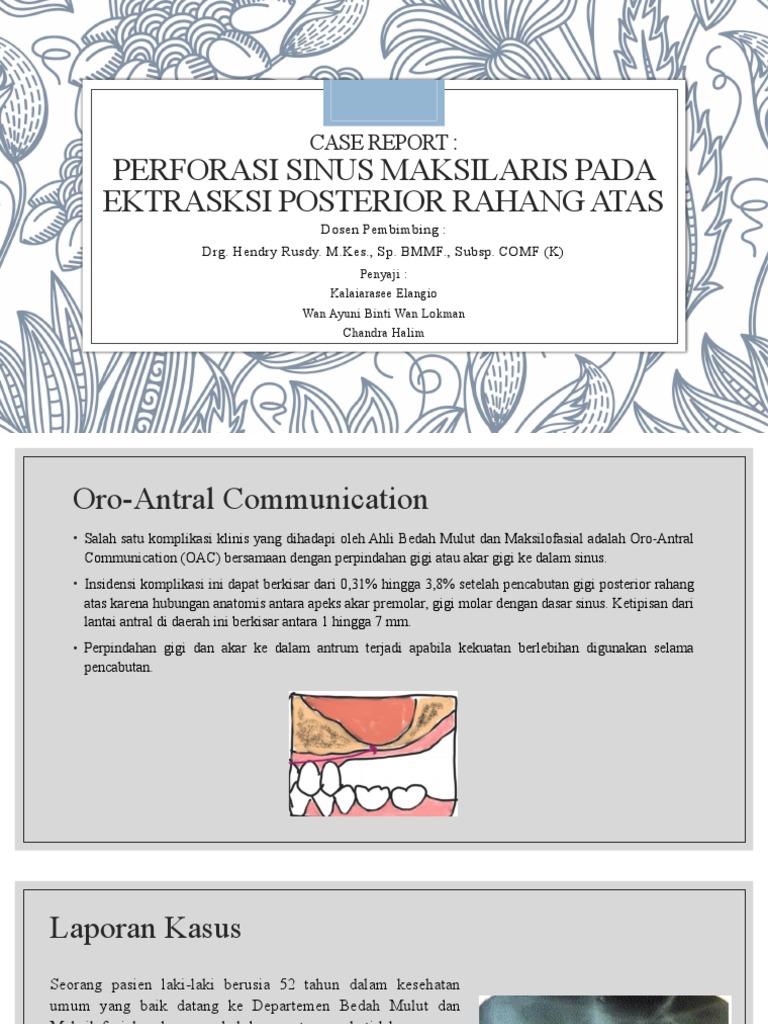 Case Report Perforasi Sinus | PDF