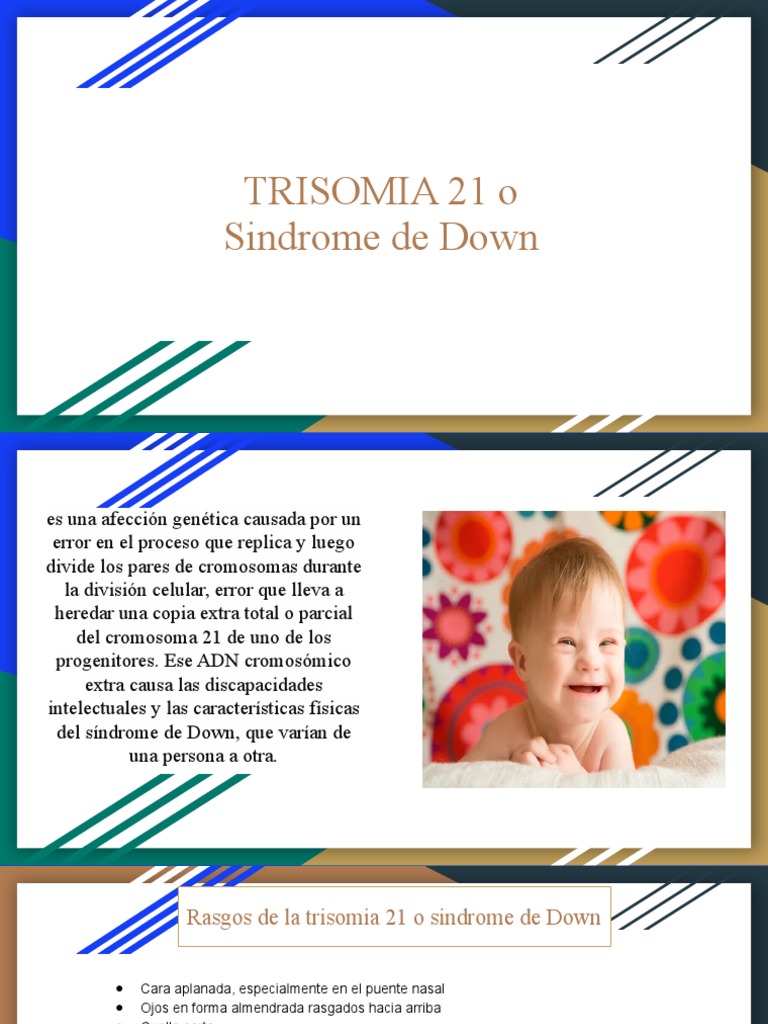 TRISOMIA 21 o Sindrome de Down | PDF | Síndrome de Down | Enfermedades y trastornos humanos