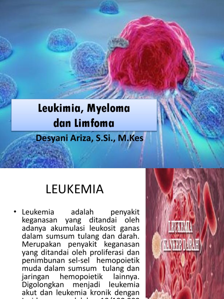 Leukimia, Myeloma Dan Limfoma | PDF