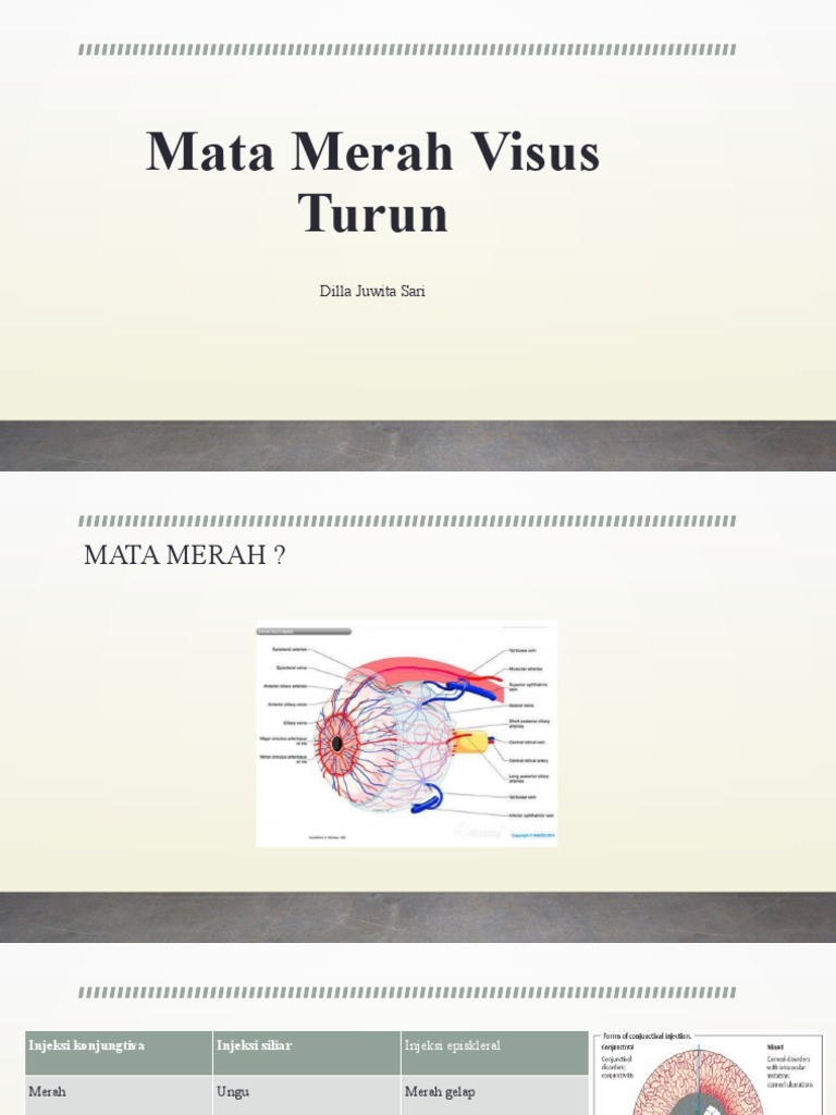 Mata Merah Visus Turun-1 | PDF | Sains & Matematika
