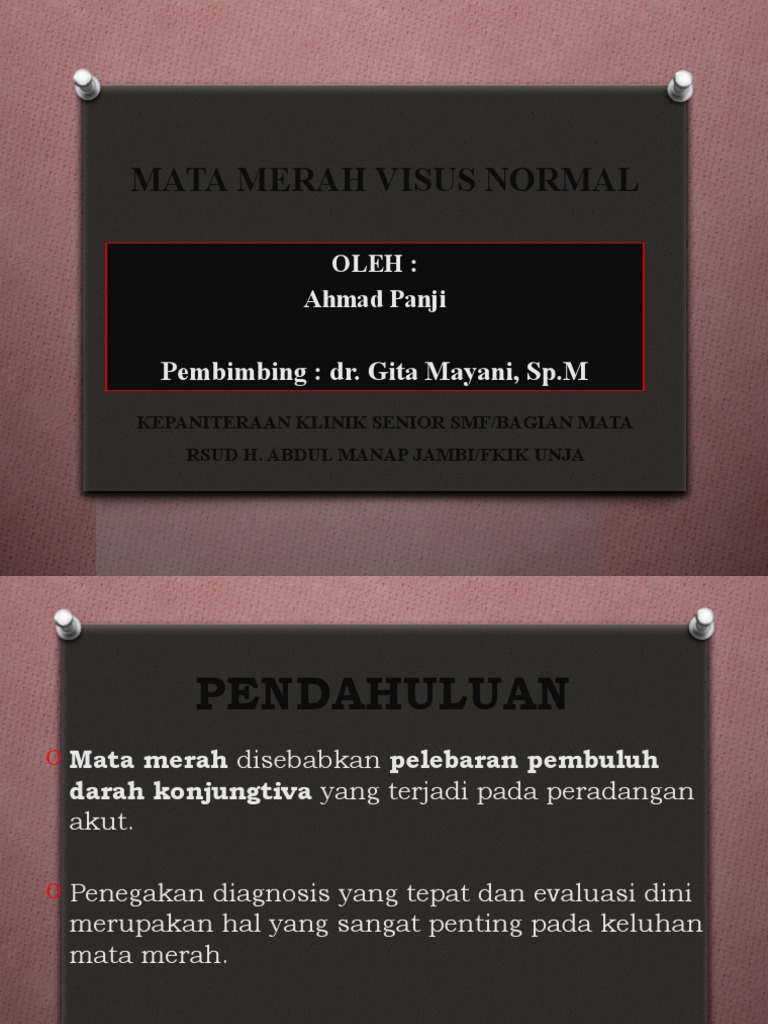 Mata Merah Visus Normal | PDF