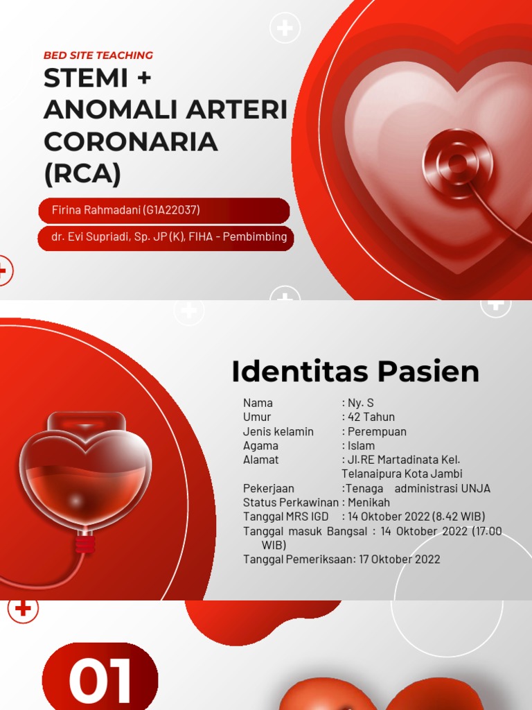 BST Stemi Anomali Rca Firina | PDF