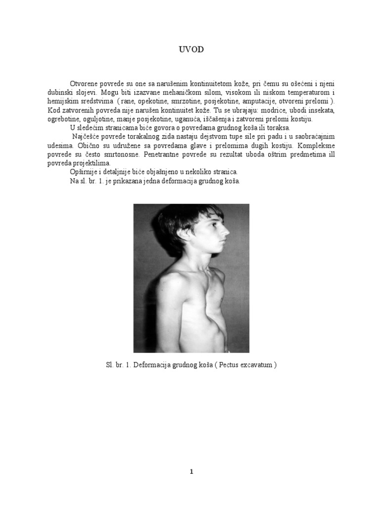 Povrede Grudnog Kosa Muric | PDF