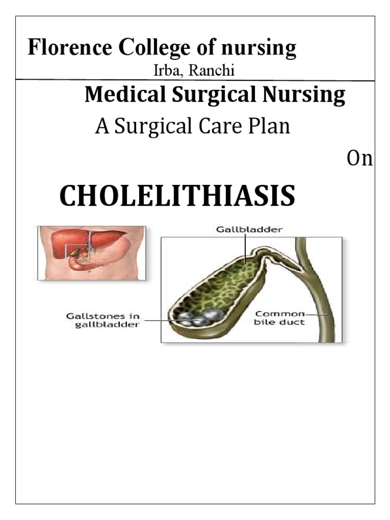 Care Plans-Cholelithiasis New | PDF | Human Eye | Surgery