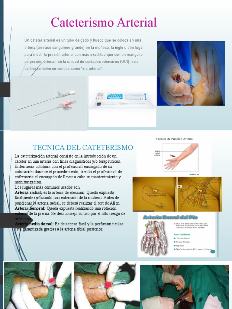 Cateterismo Arterial | PDF | Presión sanguínea | Artería