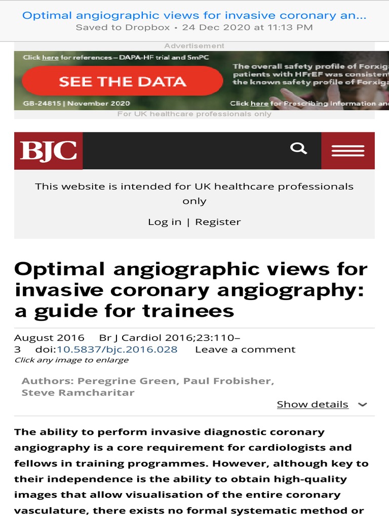 Cath Lab Optimal - Angiographic - Views - For - Invasive - Coronary ...