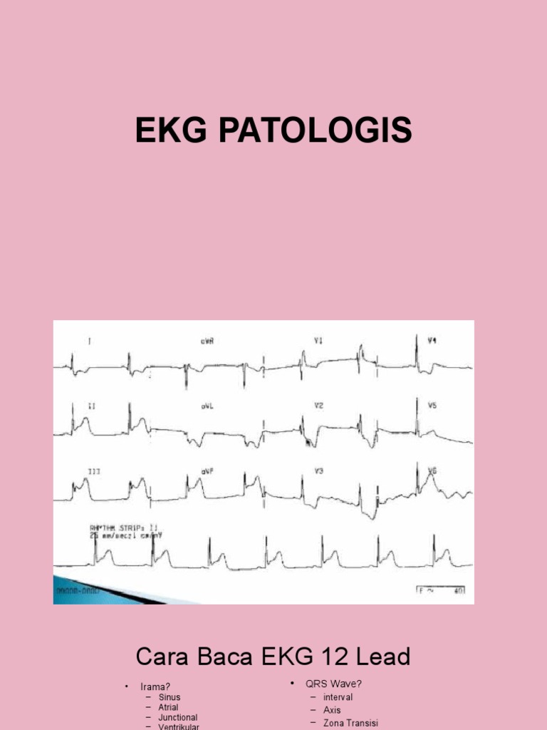 Skill - Ekg KGD | PDF