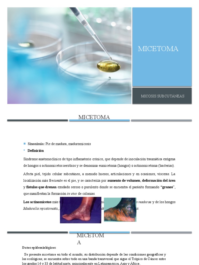Micetoma | PDF | Inmunología | Organismos