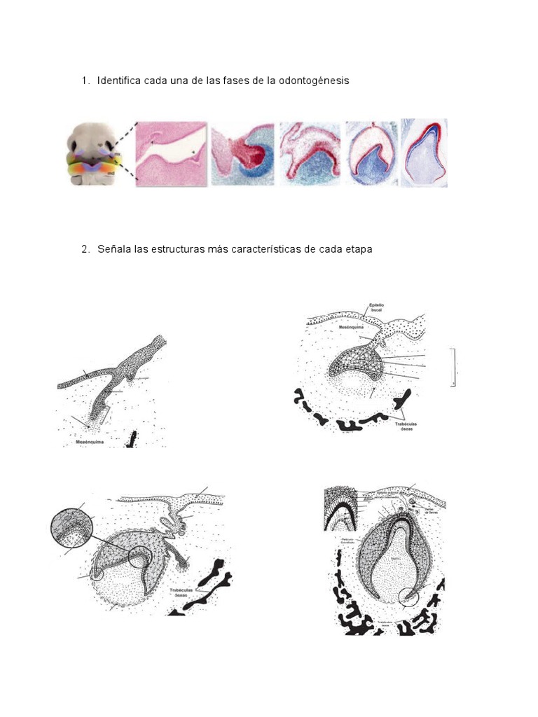 ACT. 4 - Actividades Odontogénesis | PDF