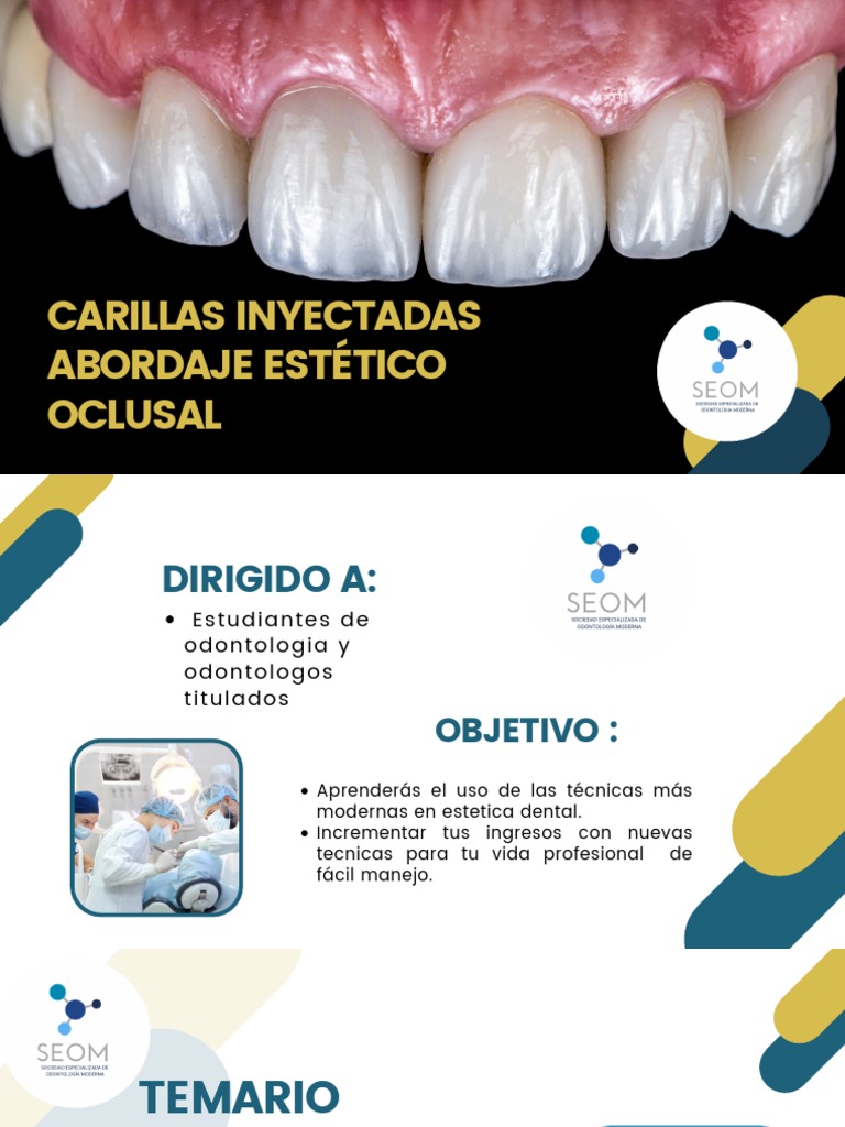 Carillas Inyectadas: Estética Dental Avanzada | PDF