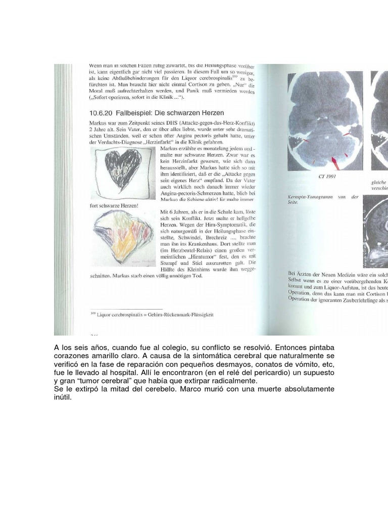 03 Pages From Nueva-medicina-germanica-Parte-I-Dr - Ryke-Geerd-Hamer | PDF | Microglia | Cerebro