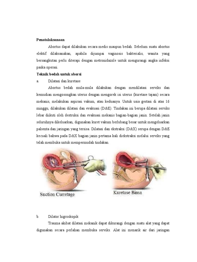 Penatalaksanaan dan Komplikasi Abortus | PDF | Kesehatan Holistik ...