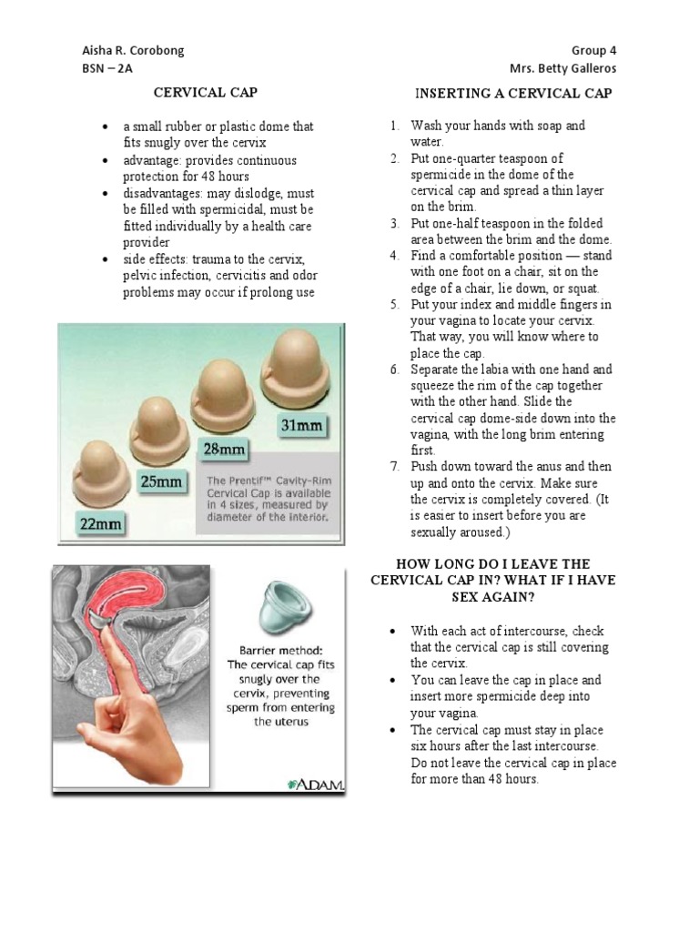 Cervical Cap | PDF | Vagina | Sexual Health