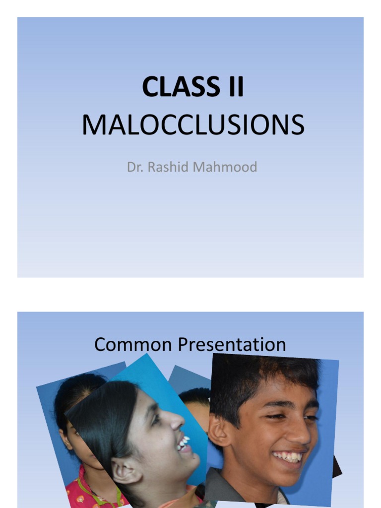 Class 2 Malocclusion | PDF