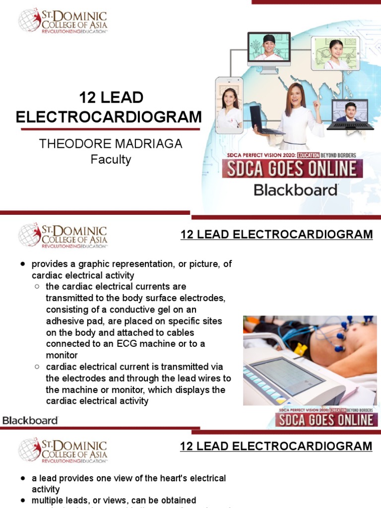 Electrocardiogram Nursing Responsibilities | PDF | Electrocardiography ...